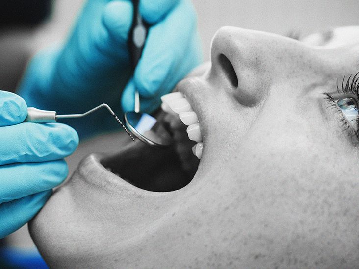 Exposed tooth root: Symptoms, treatment, pictures, and more