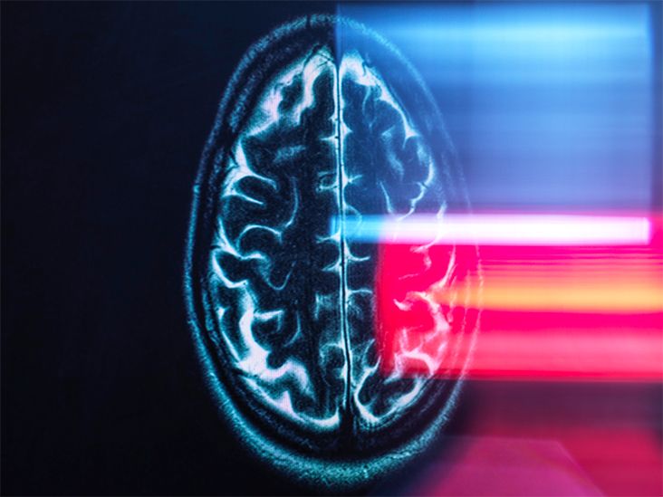 Absence seizure (petit mal): Definition, symptoms, treatment, and more