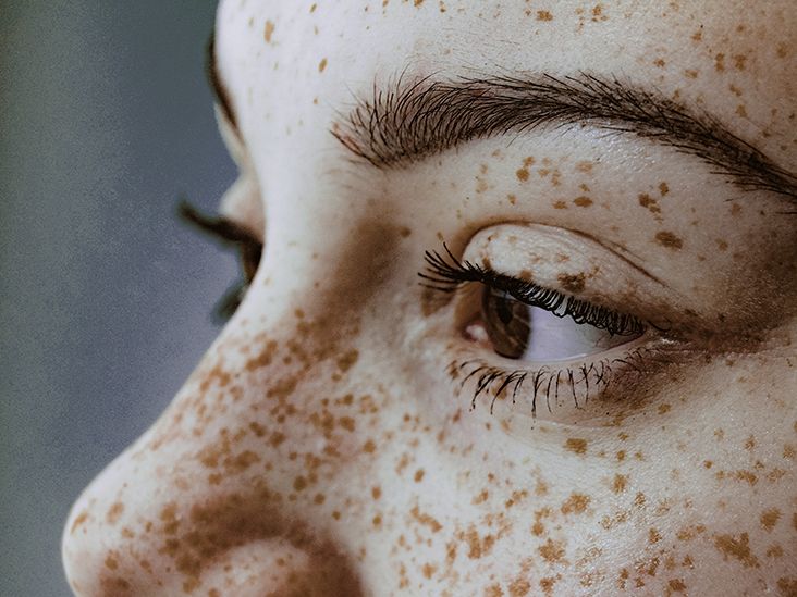 Exercises for double vision: 4 things to try