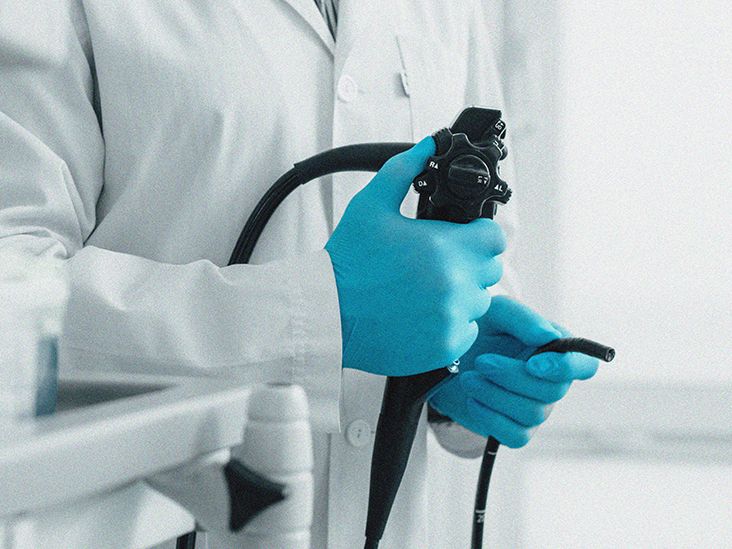 Sessile polyps: Causes, risk factors, and treatment