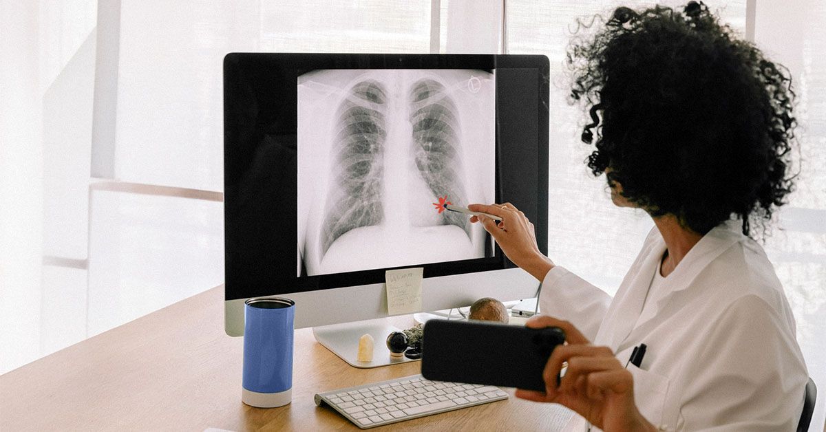 Lung biopsy: Types, procedure, recovery, and more