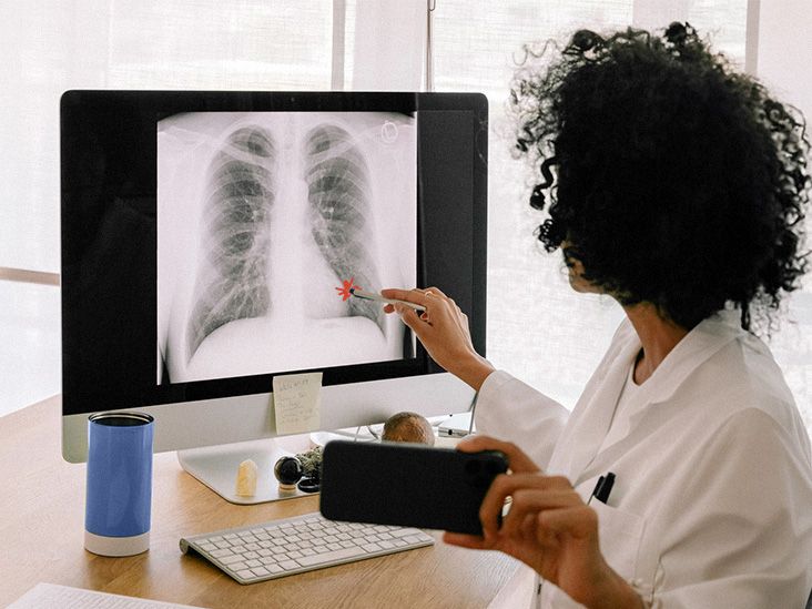 Lung biopsy: Types, procedure, recovery, and more