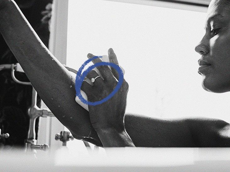 Weeping eczema: Symptoms, causes, and treatment