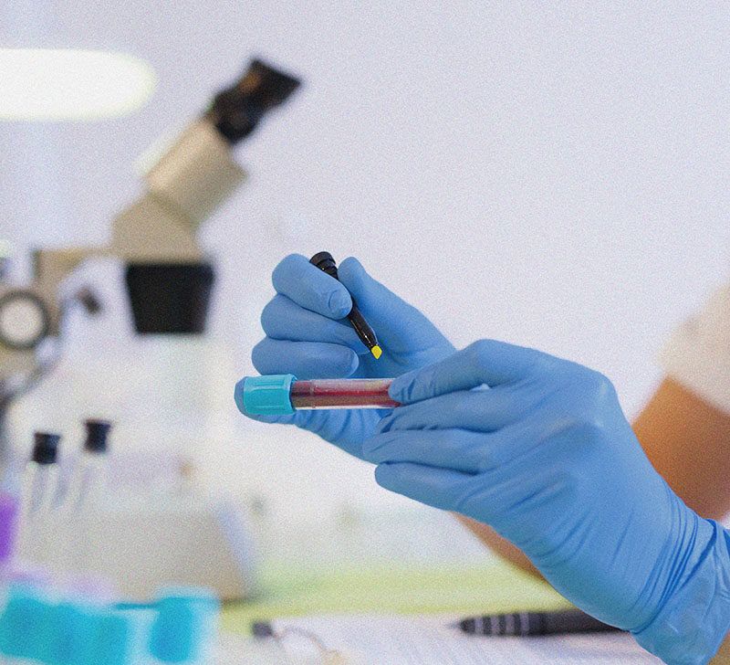 Lipid disorder: Causes, symptoms, and treatment