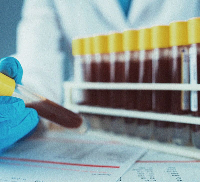 High triglycerides: Risks, causes, and treatments