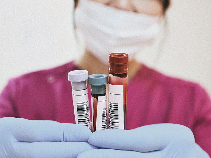 Uric acid test: Types, preparation, results, outlook, and more