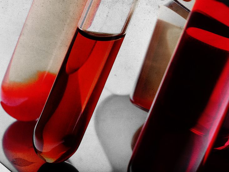 Hepatitis panel: What it involves, preparation, and results