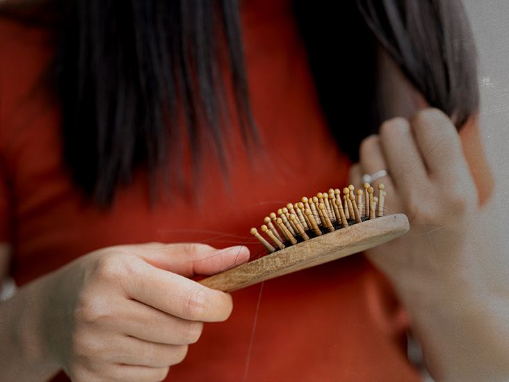 Can birth control cause hair loss? Risks and treatments