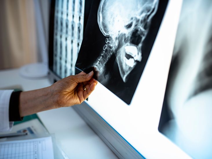 TMJ surgery: Procedures, recovery, types, and more