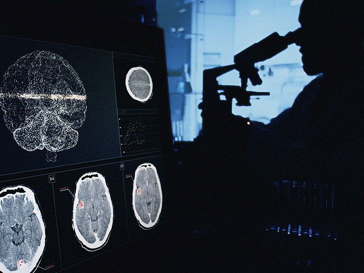 Glioma: Types, symptoms, treatment, outlook, and more