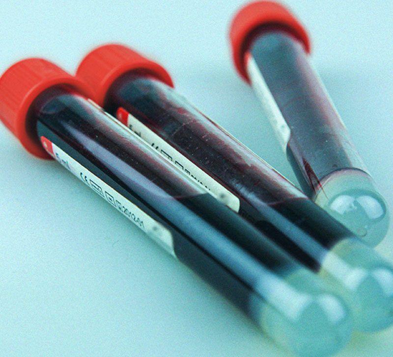 What is hematopoietic stem cell transplantation?