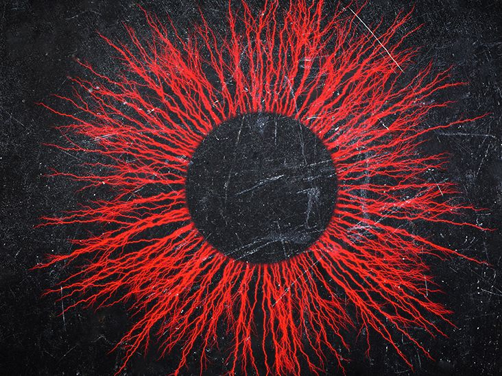 Septic shock: Prevention, treatment, and causes