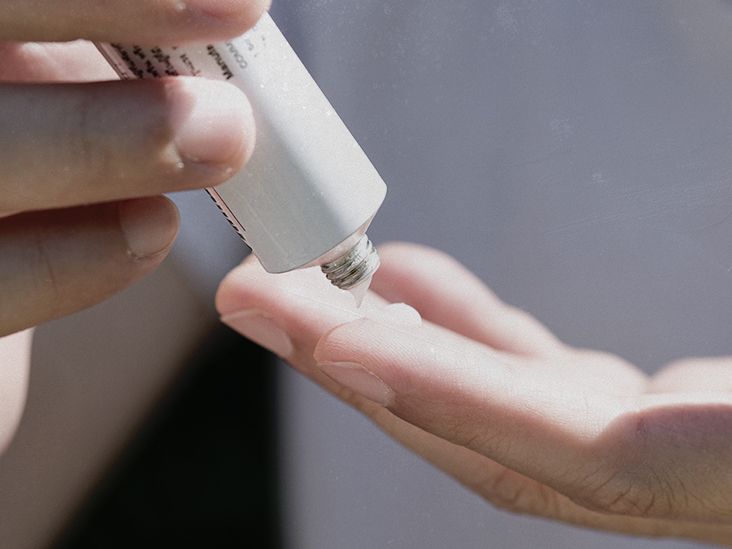 How do steroid creams help treat eczema?