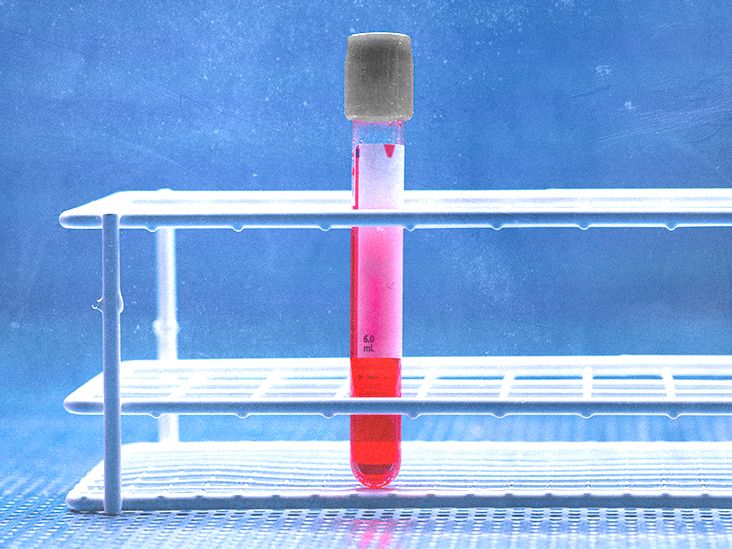 CLL flow cytometry: How it works, diagnosis, and more