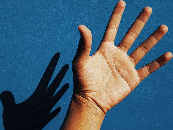 Psoriatic vs. rheumatoid arthritis: What is the difference?