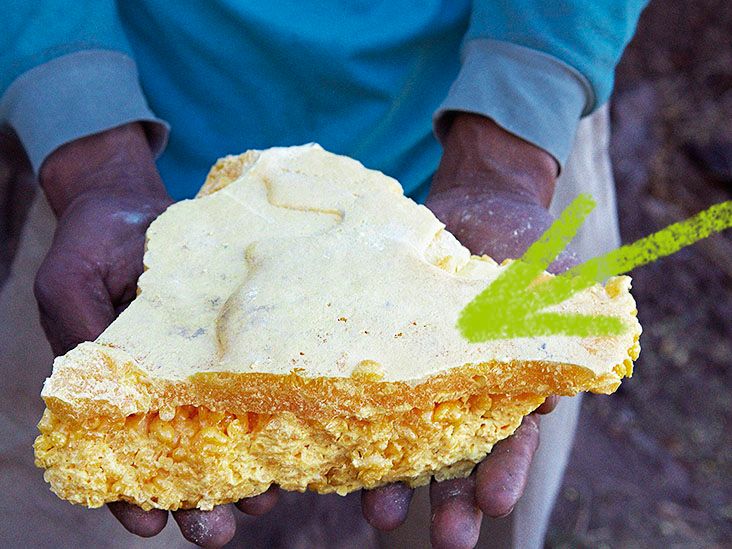 Sulfur for eczema: Does sulfur soap, cream, or ointment help?