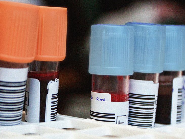 Chronic lymphocytic leukemia: Lymphocyte counts and ranges