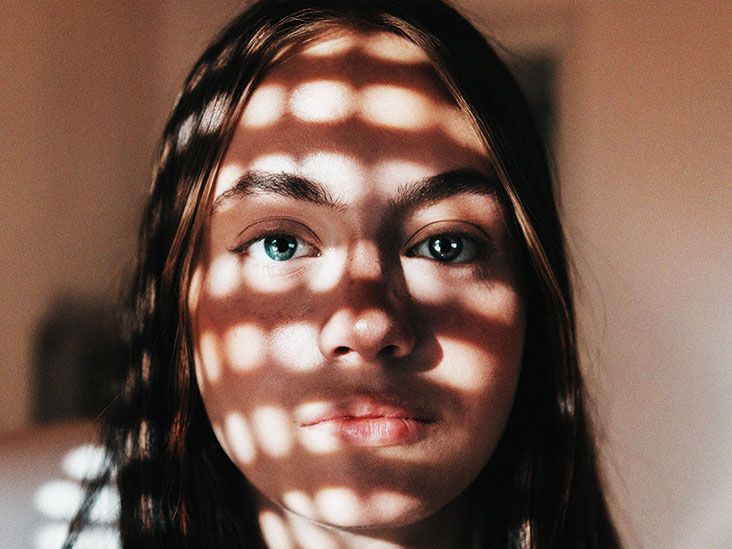 Photosensitive dermatitis: Causes, symptoms, and treatments