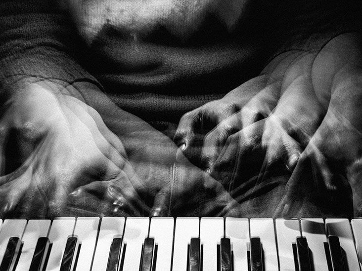 Swan neck deformity: Causes and treatment