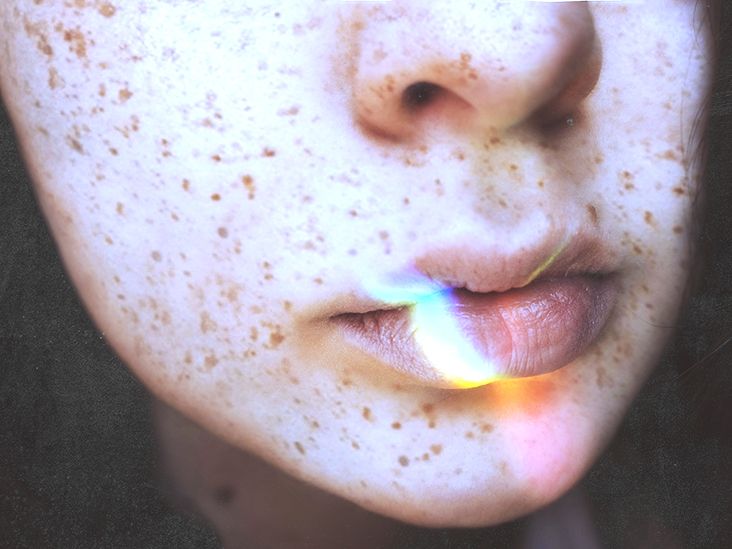 Psoriasis on lips: Symptoms, causes, treatment, and more