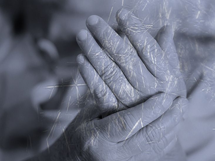 Gout crystals: Types, treatment, and prevention