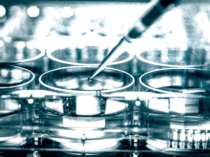 Stem cell transplants: Autologous, hematopoietic, and more