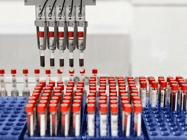 Small cell lung cancer tumor markers: Types, ranges, and more