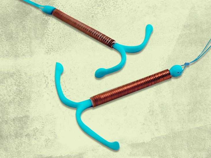 What to know about the hormonal IUD | Medical News Today