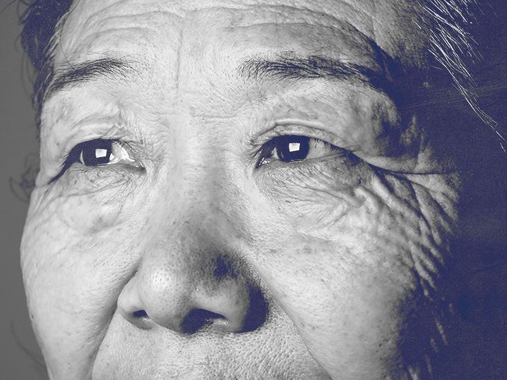 Cutaneous T-cell lymphoma: Pictures, outlook, and more