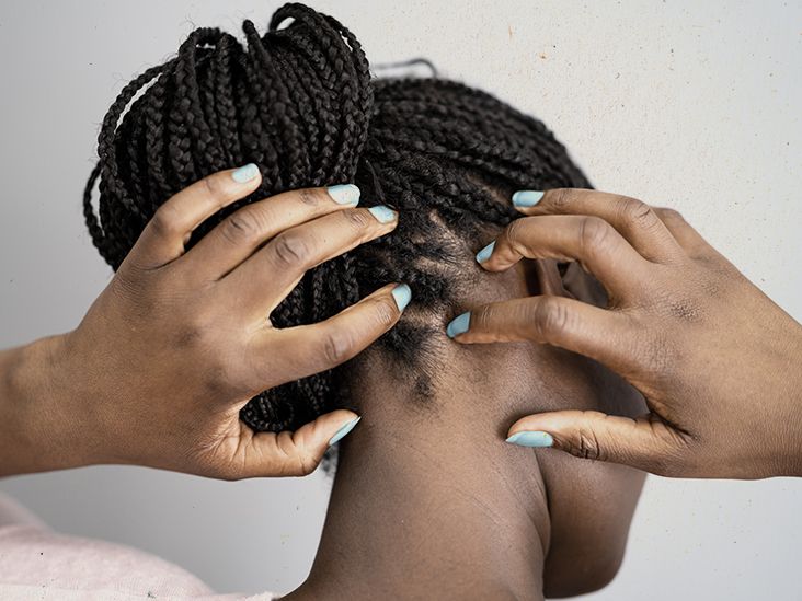 Psoriasis vulgaris: Pictures, symptoms, treatments, and more