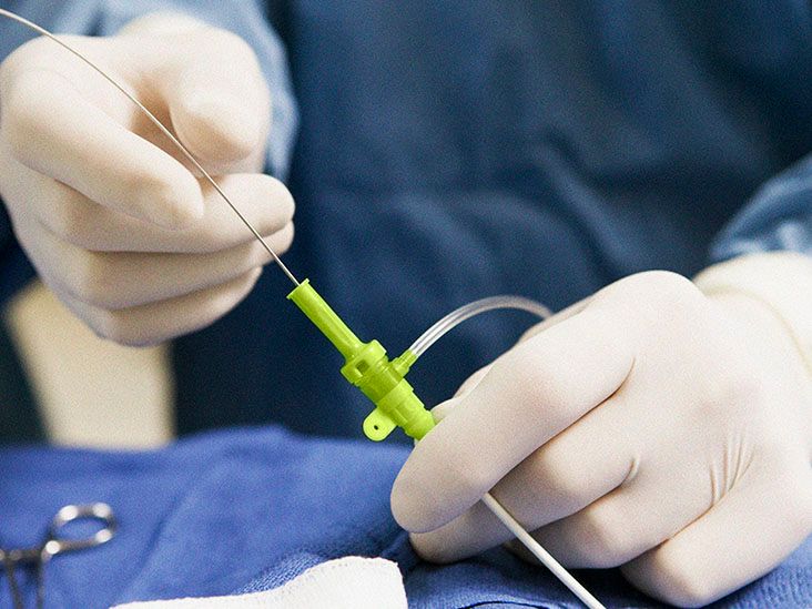 Cardiac catheterization: Definition, benefits, risks, and more