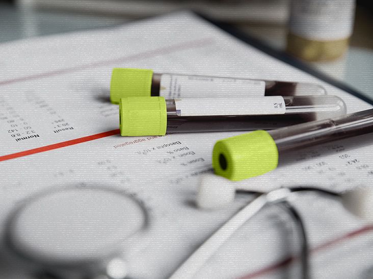 Lymphoplasmacytic lymphoma: Treatment, outlook, and more