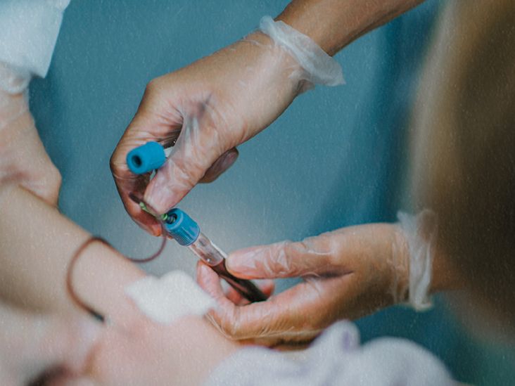 AML types: Classification and identification