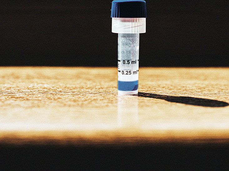 Serum cholesterol: What to know and how to manage levels