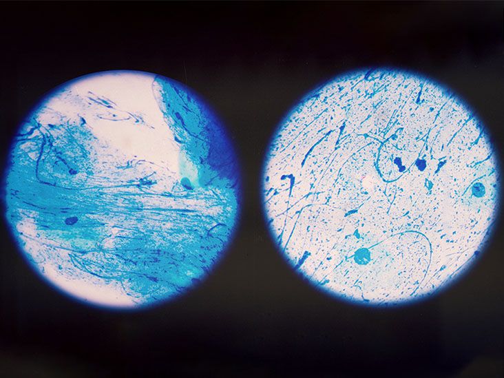 How does a TB blood test work and who should get it?