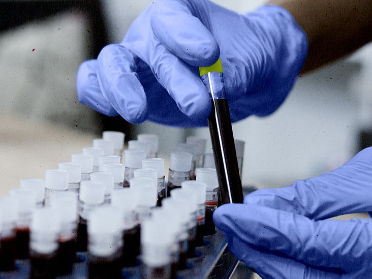 Chronic eosinophilic leukemia: Symptoms, diagnosis, treatment