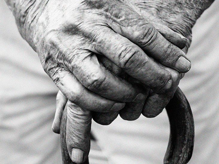 Gout: Complications and long-term management