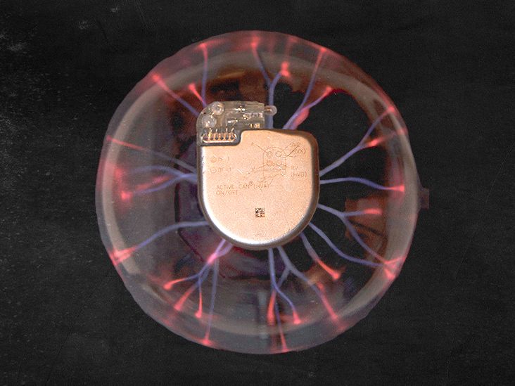 Implantable cardioverter defibrillators: What to know