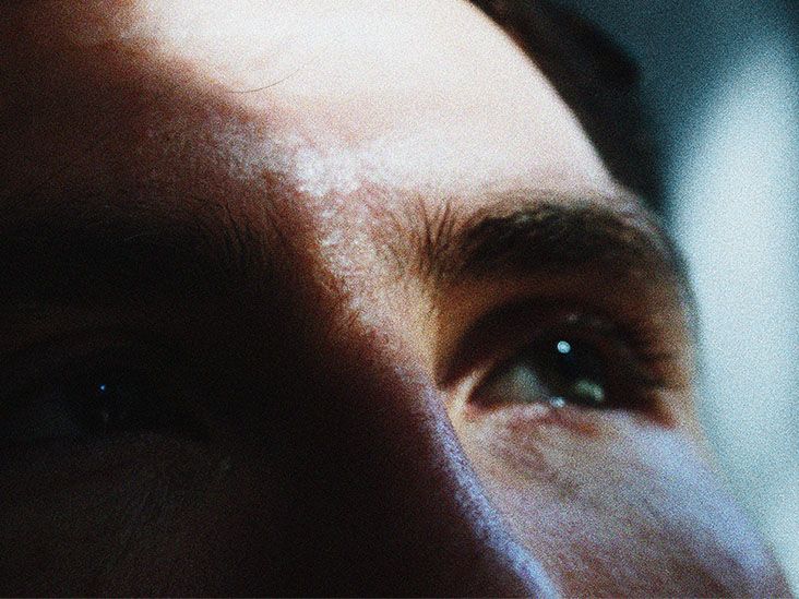 Exudative macular degeneration: Signs and treatment