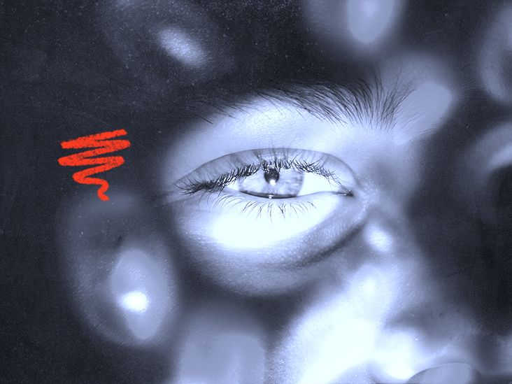 Neurotrophic keratoconjunctivitis: Causes and treatment