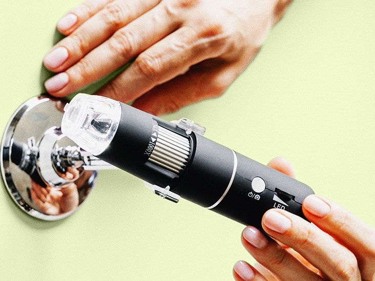 Ostraceous psoriasis: Symptoms, diagnosis, treatment