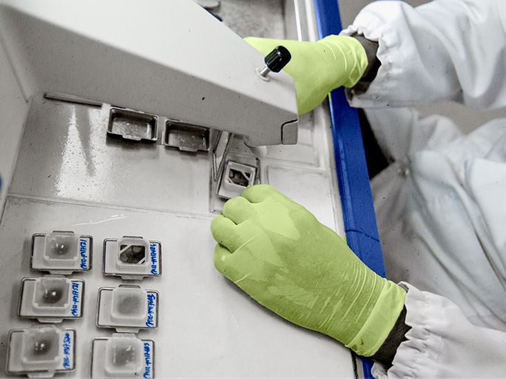 UC histology: What to expect