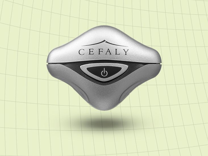 Cefaly for migraine review: What to know