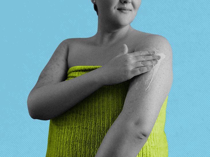 The 6 best capsaicin creams: Uses, options, and risks