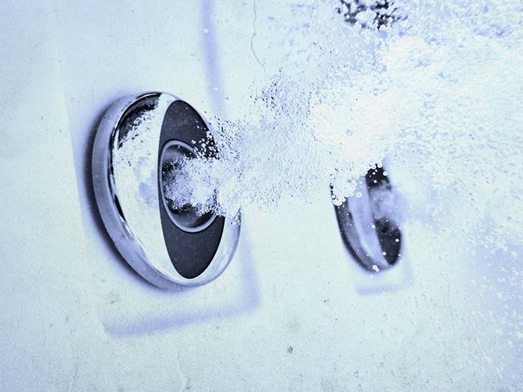 Hot tub folliculitis: Rash pictures, symptoms, treatment, and causes