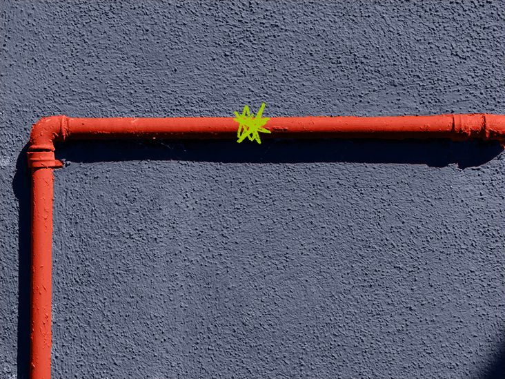 Ileus: Symptoms, causes, treatment, and recovery