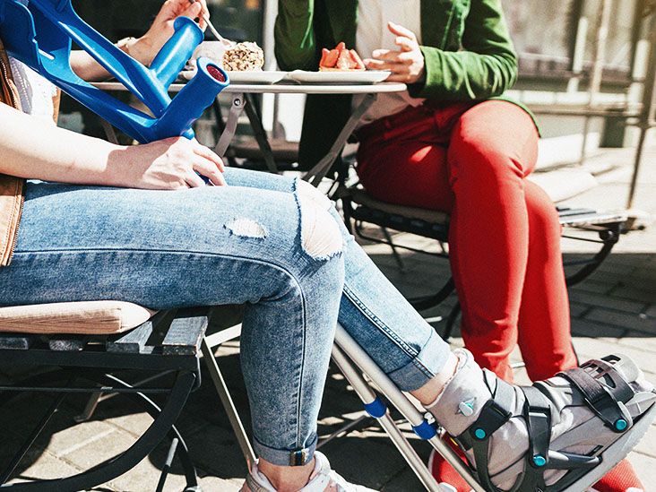Broken foot: Symptoms, what does it look like, recovery, and treatment