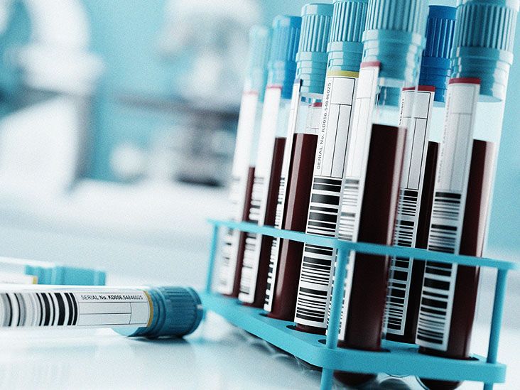 FSH levels: Normal ranges, high and low results, and symptoms