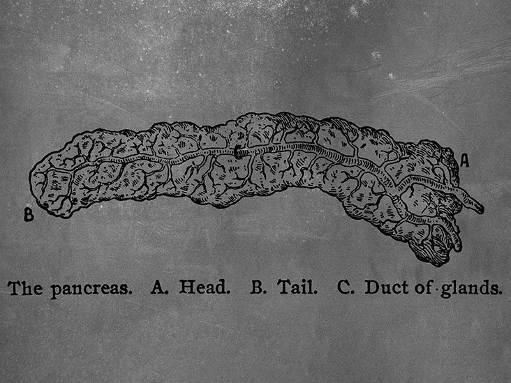 Gallstone pancreatitis: Causes, symptoms and treatments