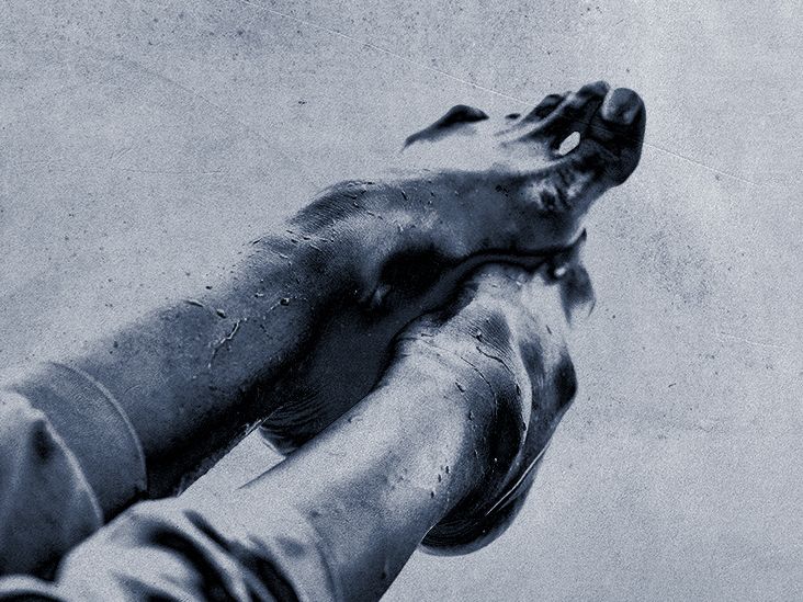 Rheumatoid arthritis vasculitis: Symptoms and treatment